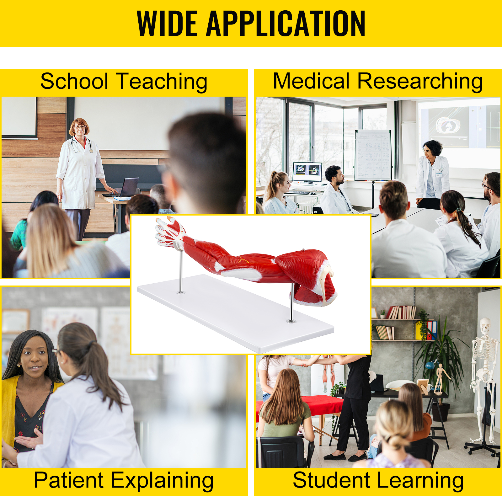 Vevor Arm Muscle Modelmuscular Arm Anatomy Model 7 Parts Medical ...