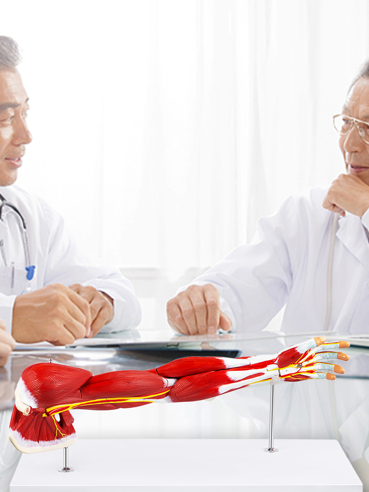 Vevor Arm Muscle Modelmuscular Arm Anatomy Model 7 Parts Medical ...