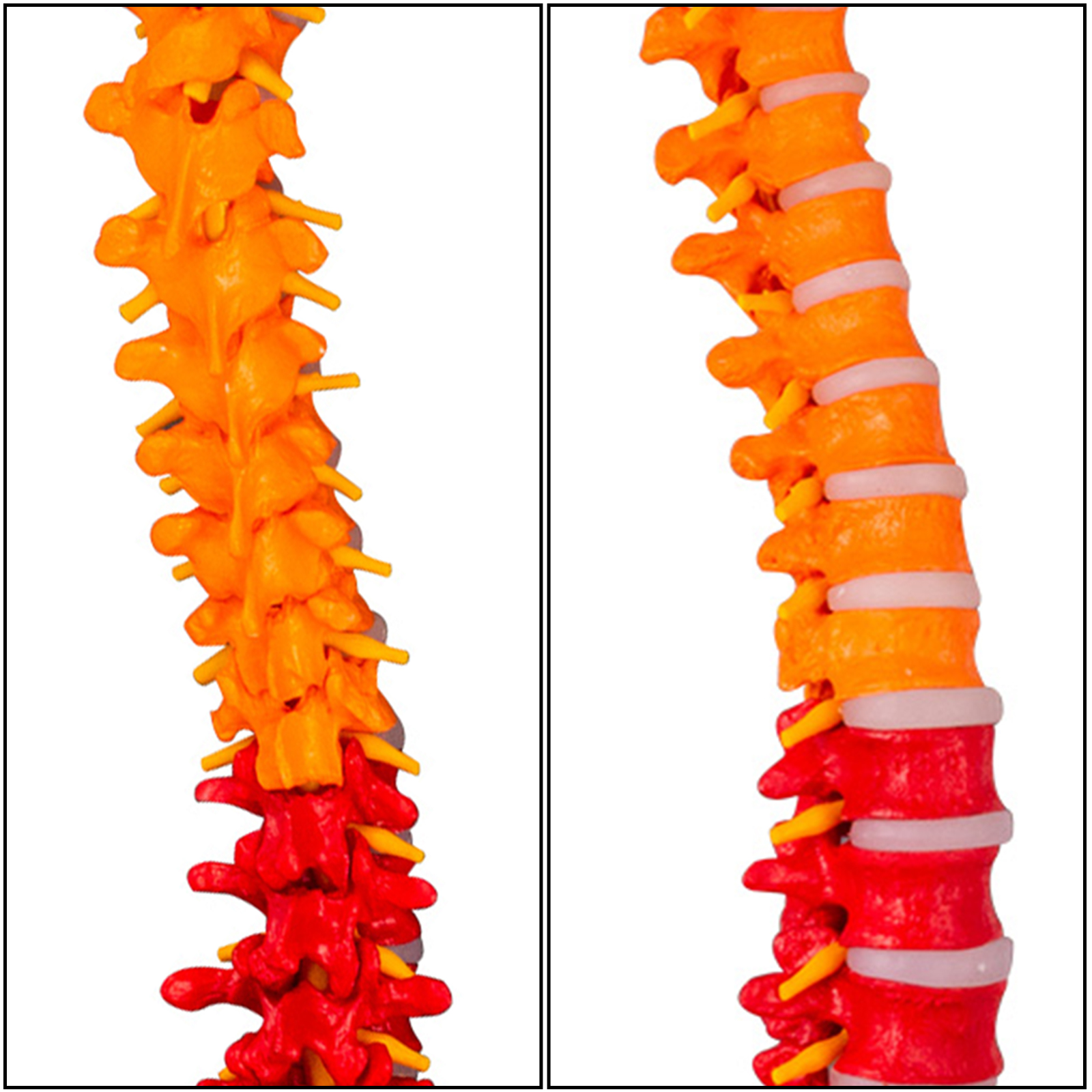 Vertebral Column Model Skeleton Spine Model 85cm Spine Model Spinal ...